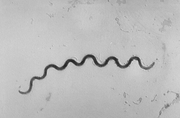 Positive Lyme Test Could Mean Syphilis Morgellons Survey positive-lyme-test-could-mean-syphilis-morgellons-survey